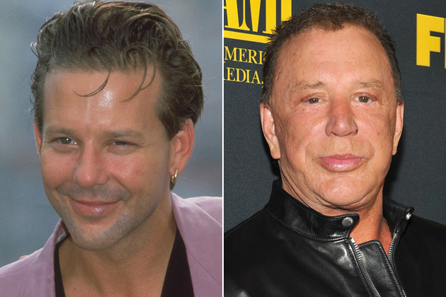 Los famosos que se hicieron feos de tanta cirugía